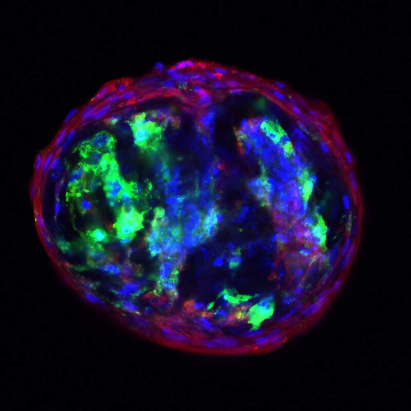 PRODUCTS - Evercyte - Forever is just enough