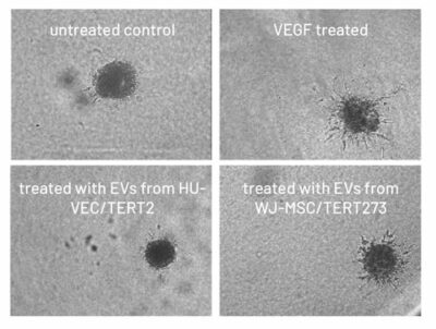 3D spheroid assay for screening of modulation of angiogenesis ...