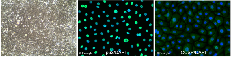 Human bronchial epithelial cells - Evercyte - Forever is just enough