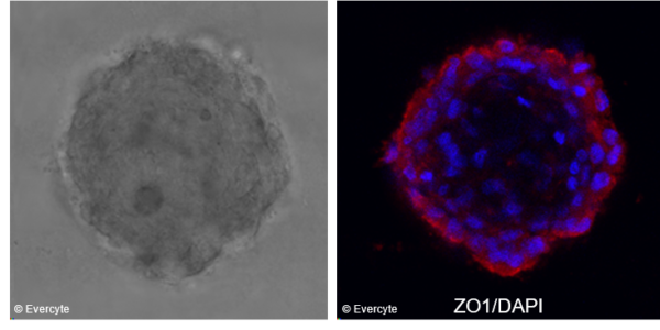 human colon epithelial cell - HCEC-1CT