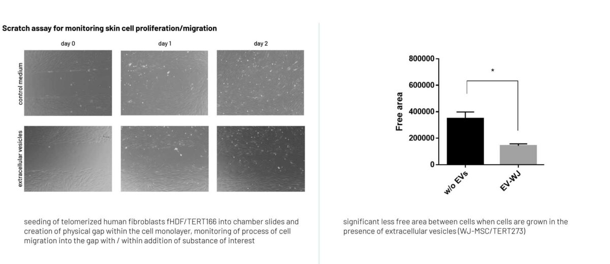 Scratch assay for monitoring skin cell proliferation / migration ...