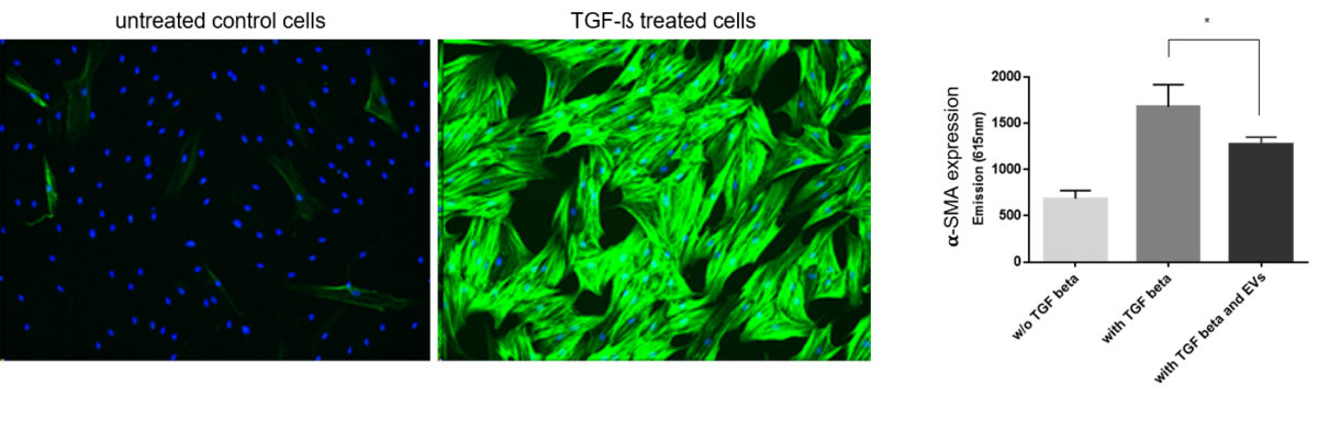 Human dermal fibroblast - Evercyte - Forever is just enough Human dermal fibroblast - Evercyte - Forever is just enough