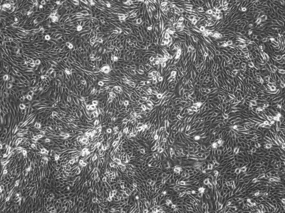 PODO/TERT256 - Evercyte - Forever is just enough